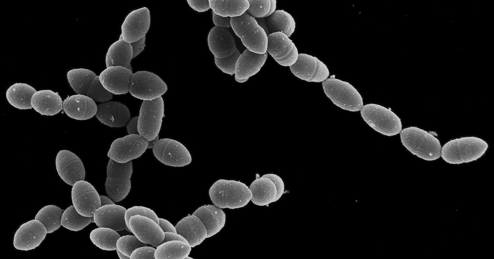 HZI | Long-term effects of influenza A virus infections on lung cells and their response to ...