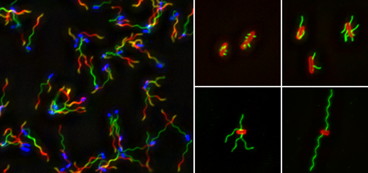 HZI | Deciphering the motility apparatus of bacteria