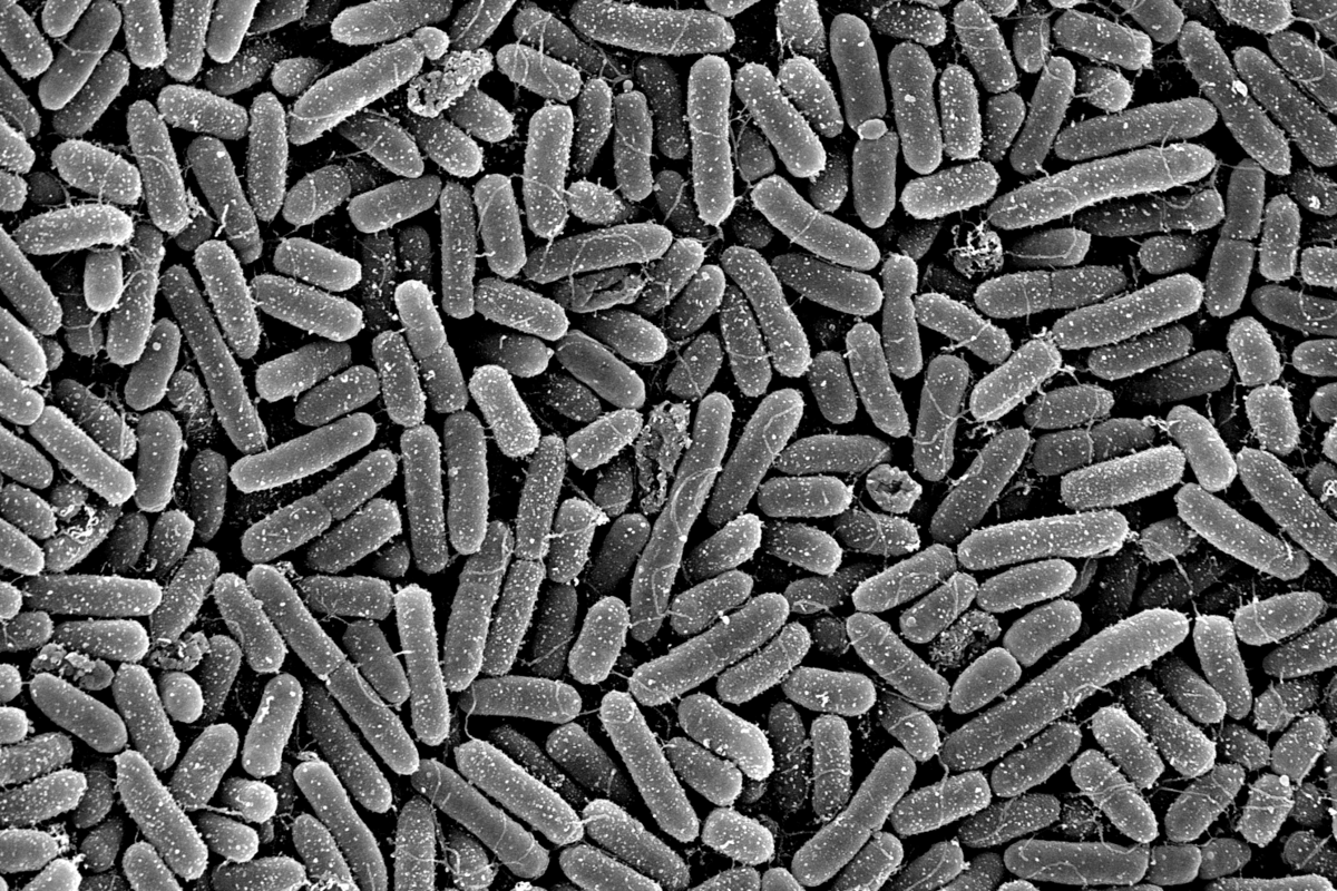 HZI | Neuer Ansatzpunkt im Kampf gegen Pseudomonas aeruginosa entdeckt
