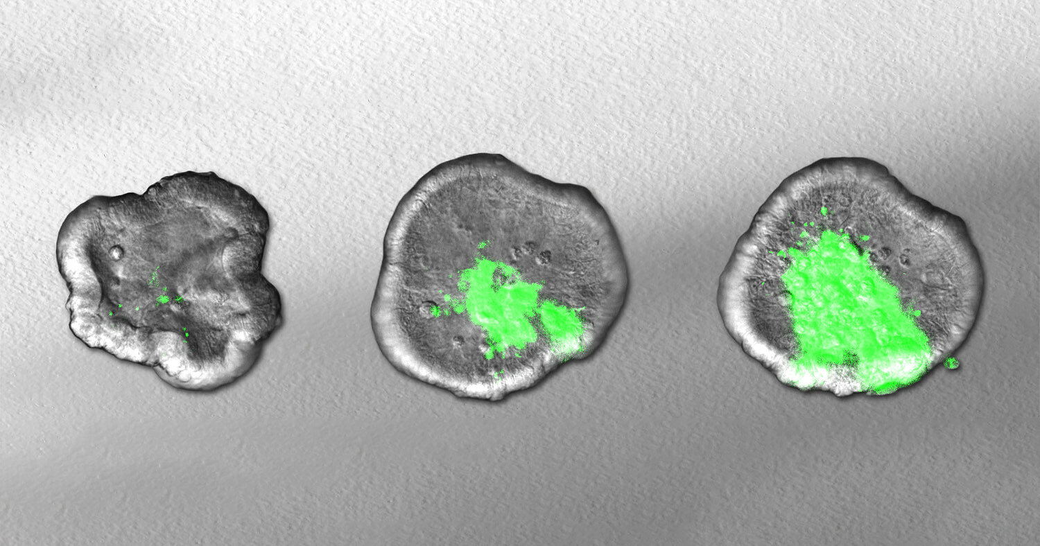 HZI | Cultured mini-organs reveal the weapons of aggressive bacteria