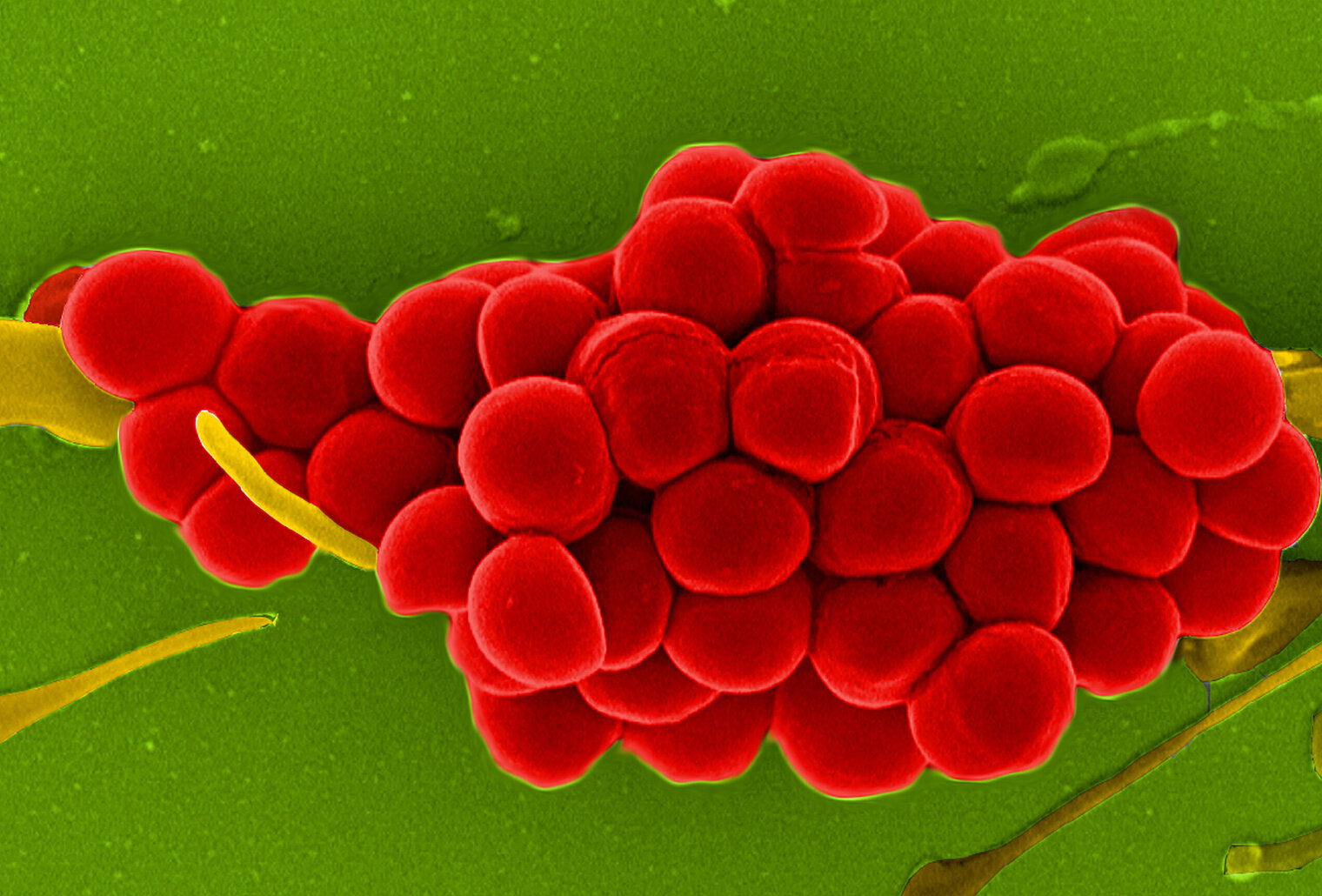 HZI | Pressematerial