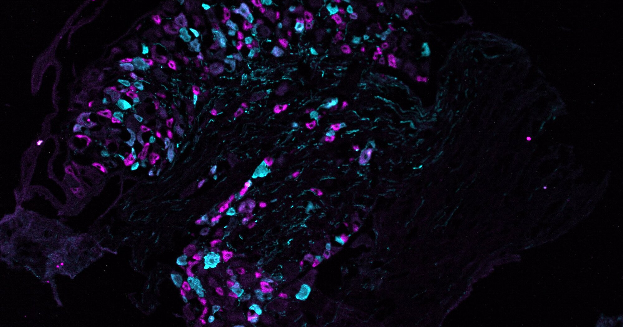 HZI | Pathways in Infection and Nociception