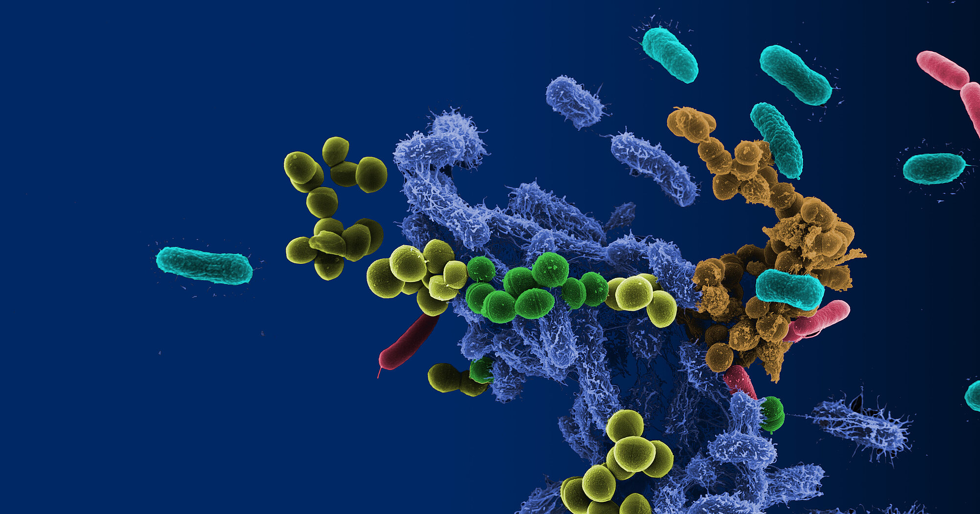 HZI | Helmholtz Centre for Infection Research (HZI)