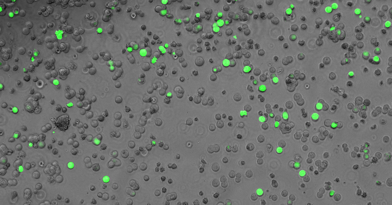 HZI | Innovative Organoid Research