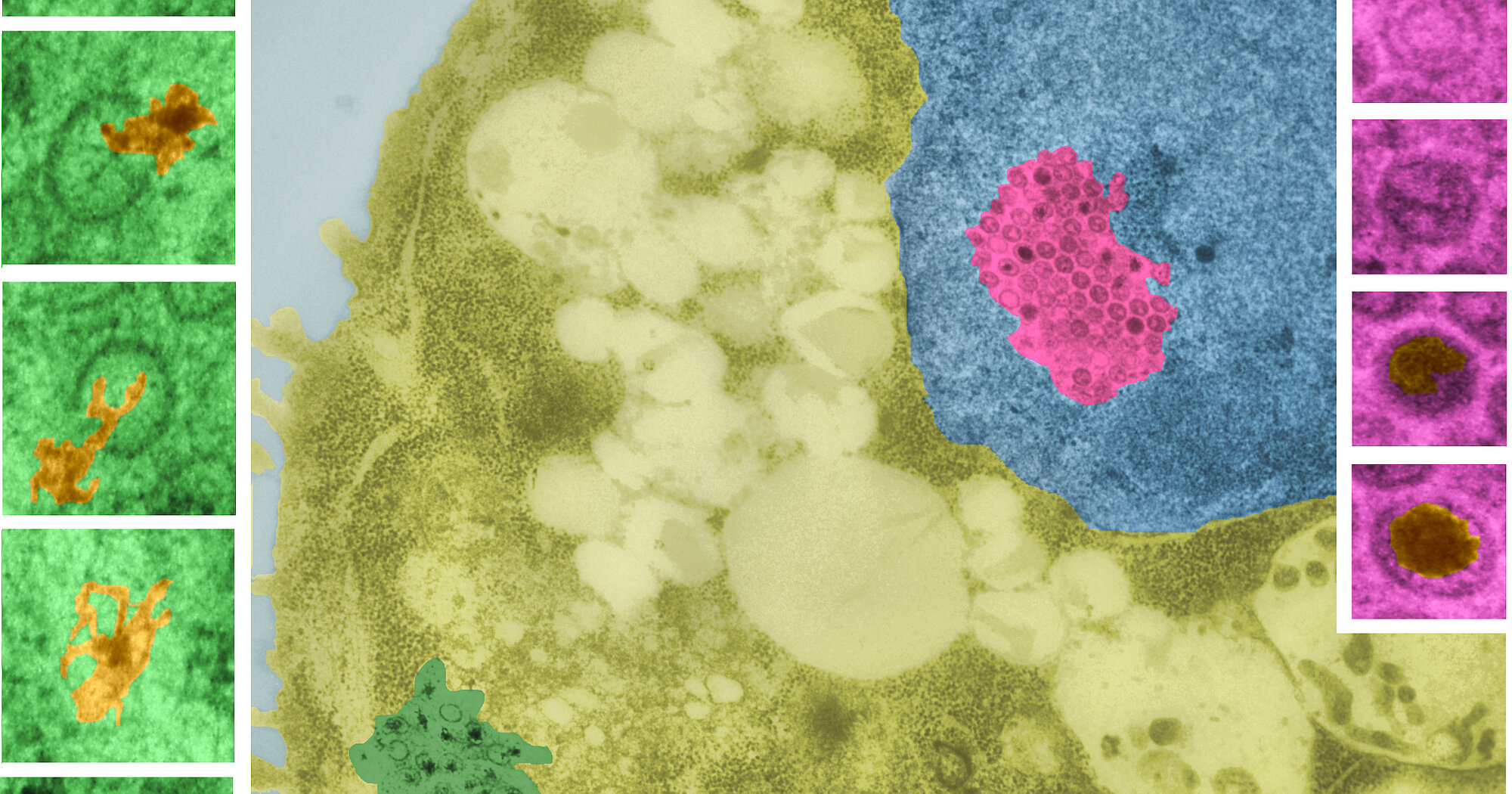 HZI | Herpes Viruses - A Large Family