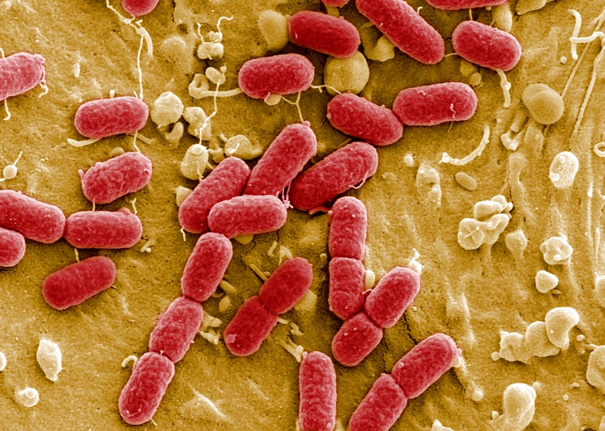 HZI | Enterohämorrhagische Escherichia coli – EHEC